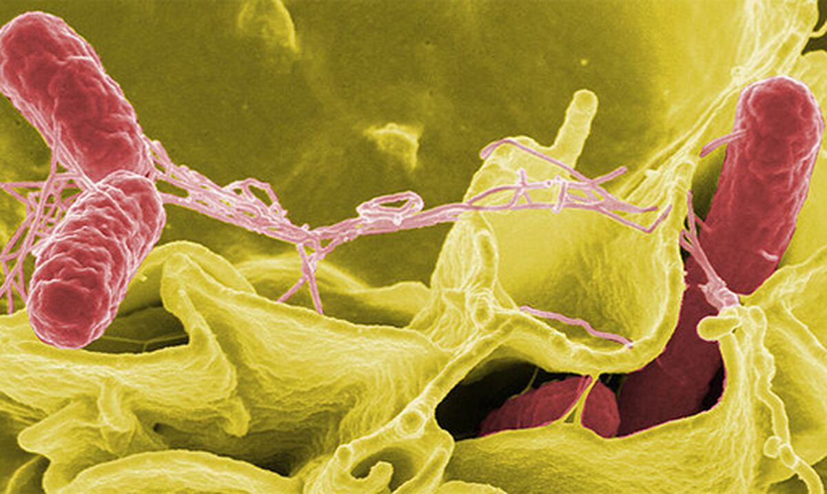 10 bacterias que matan - Primera Hora