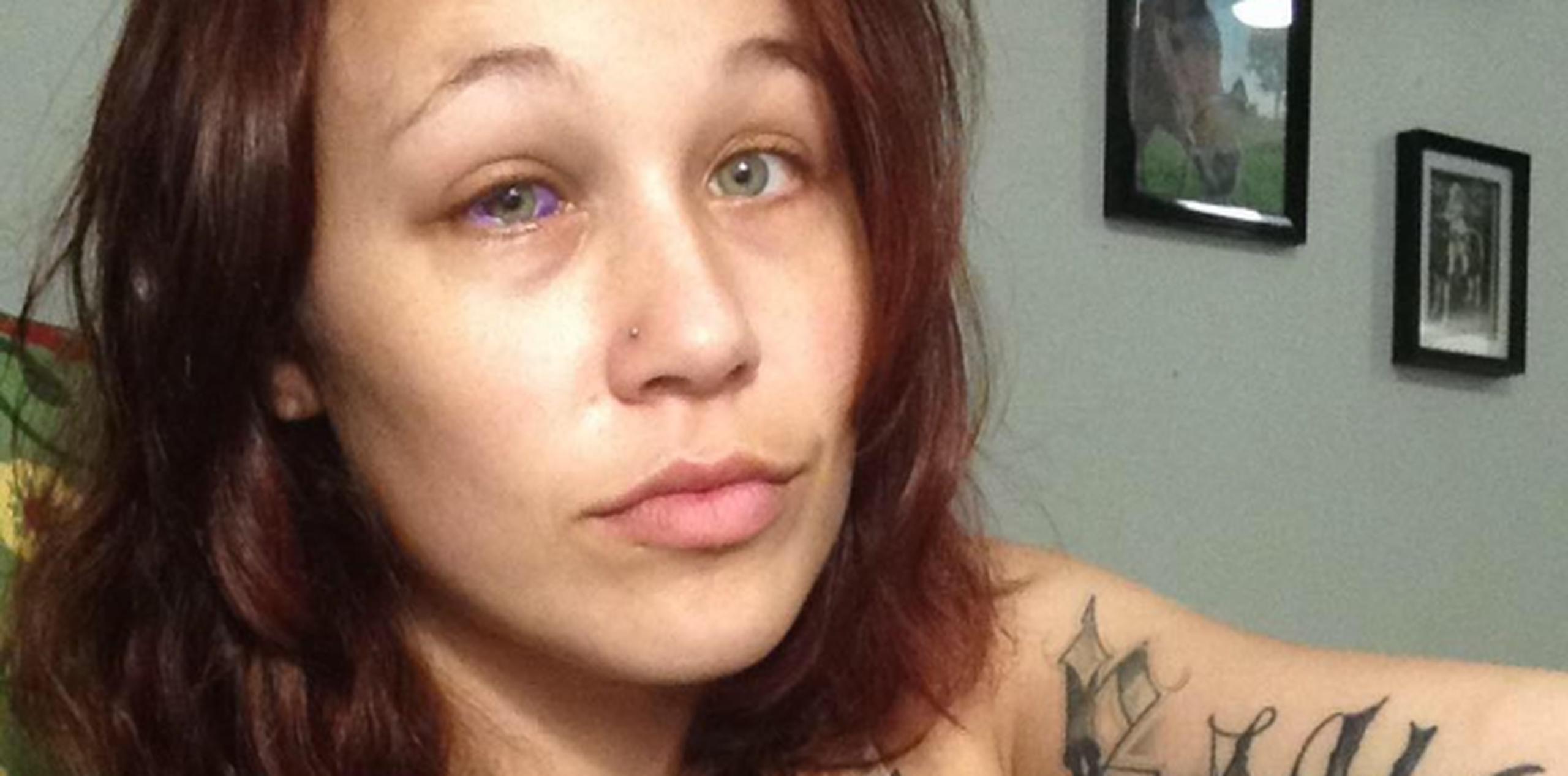 Modelo quiso tatuarse el ojo y quedó parcialmente ciega - Primera Hora