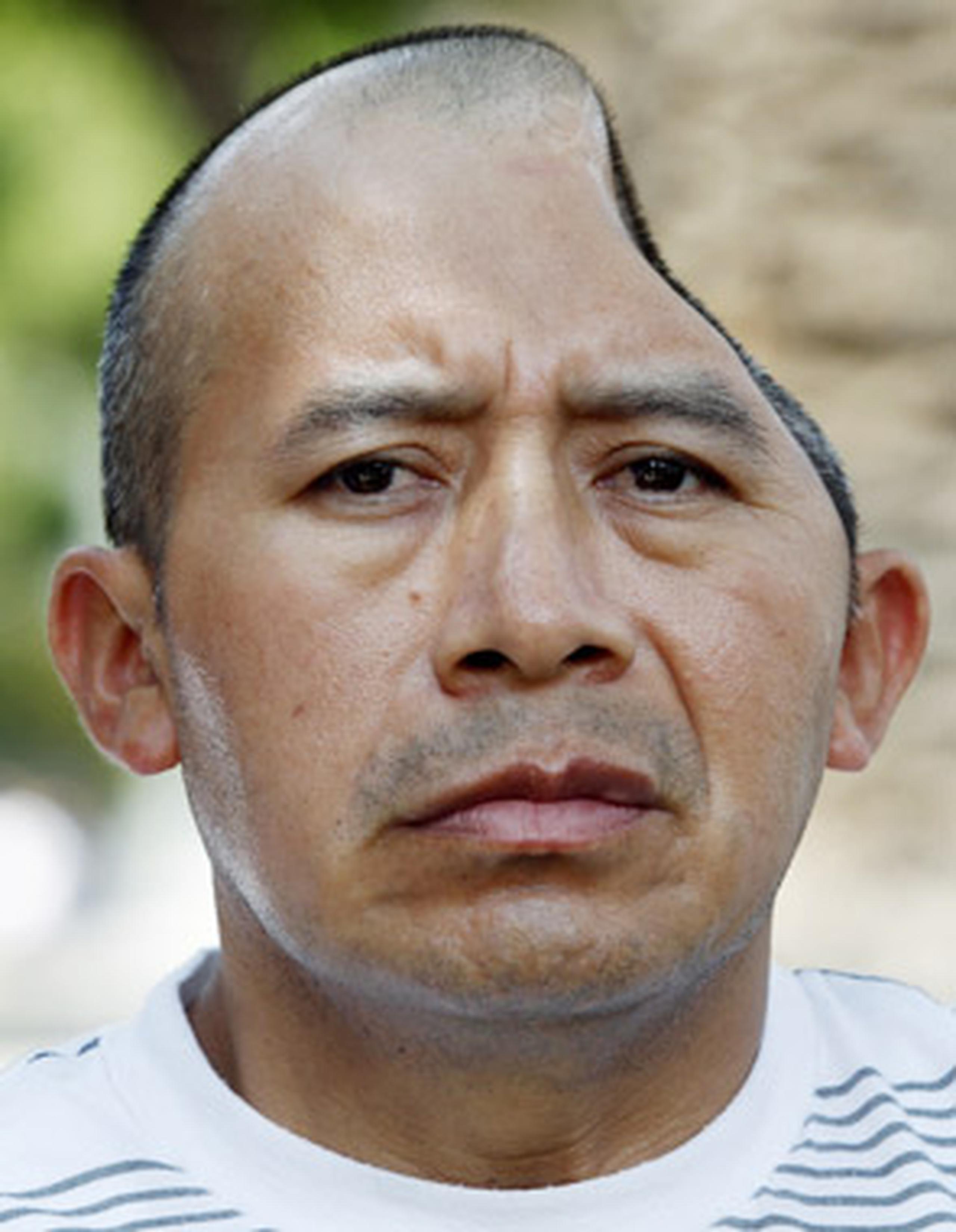 Pintor que recibió una paliza gana demanda por $58 millones - Primera Hora