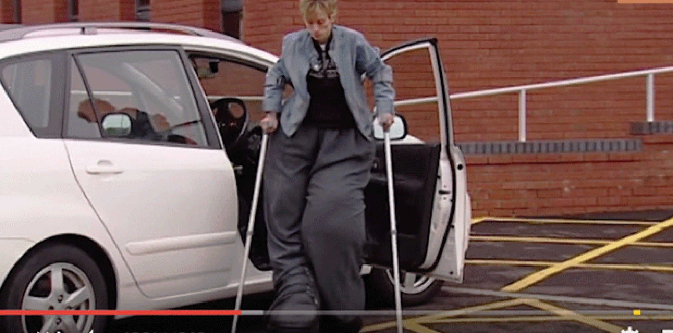 Mandy Sellars, la mujer cuyas piernas crecen sin control - Primera Hora