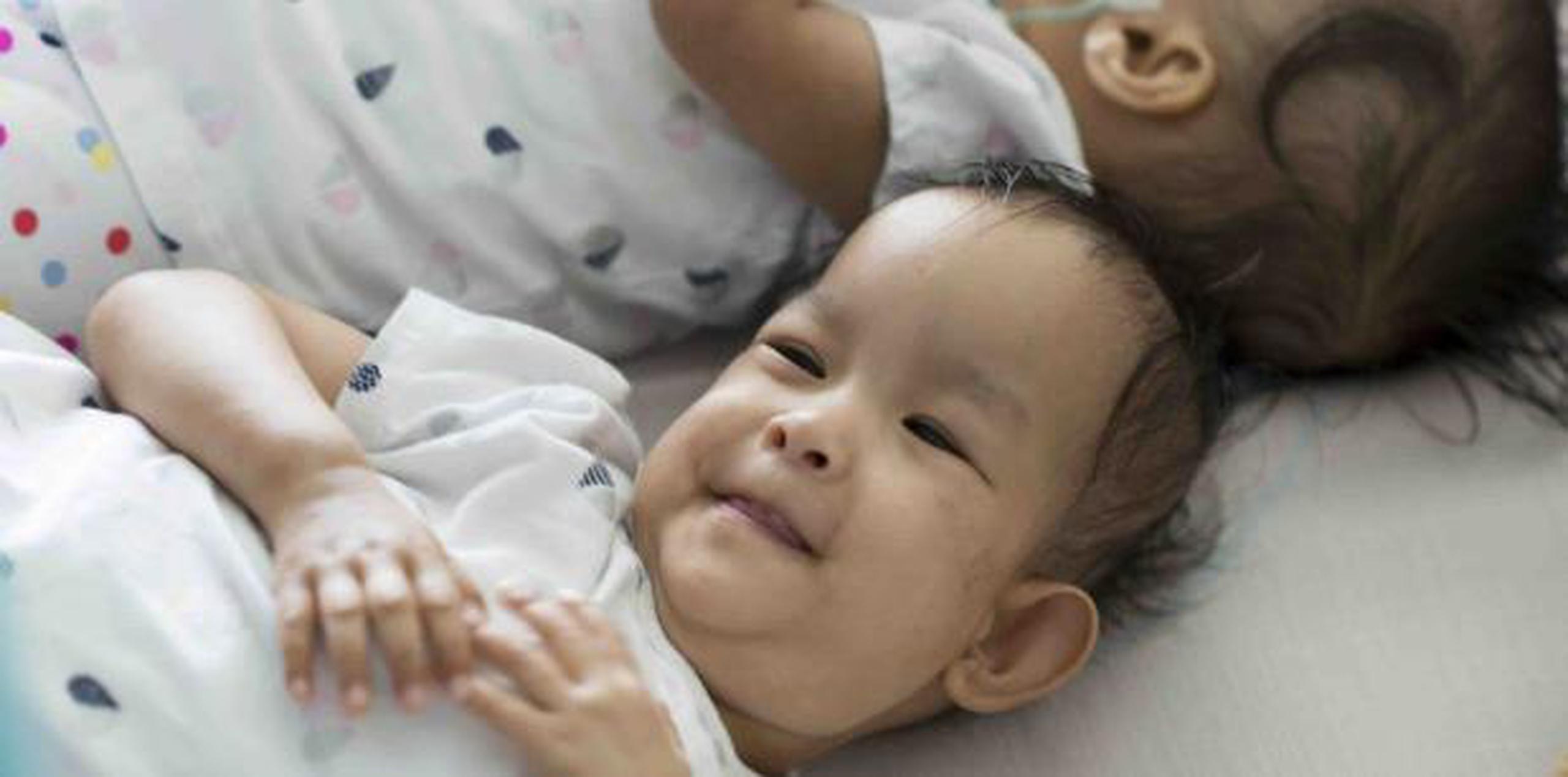 Imposible mantener a siamesas separadas tras cirugía - Primera Hora