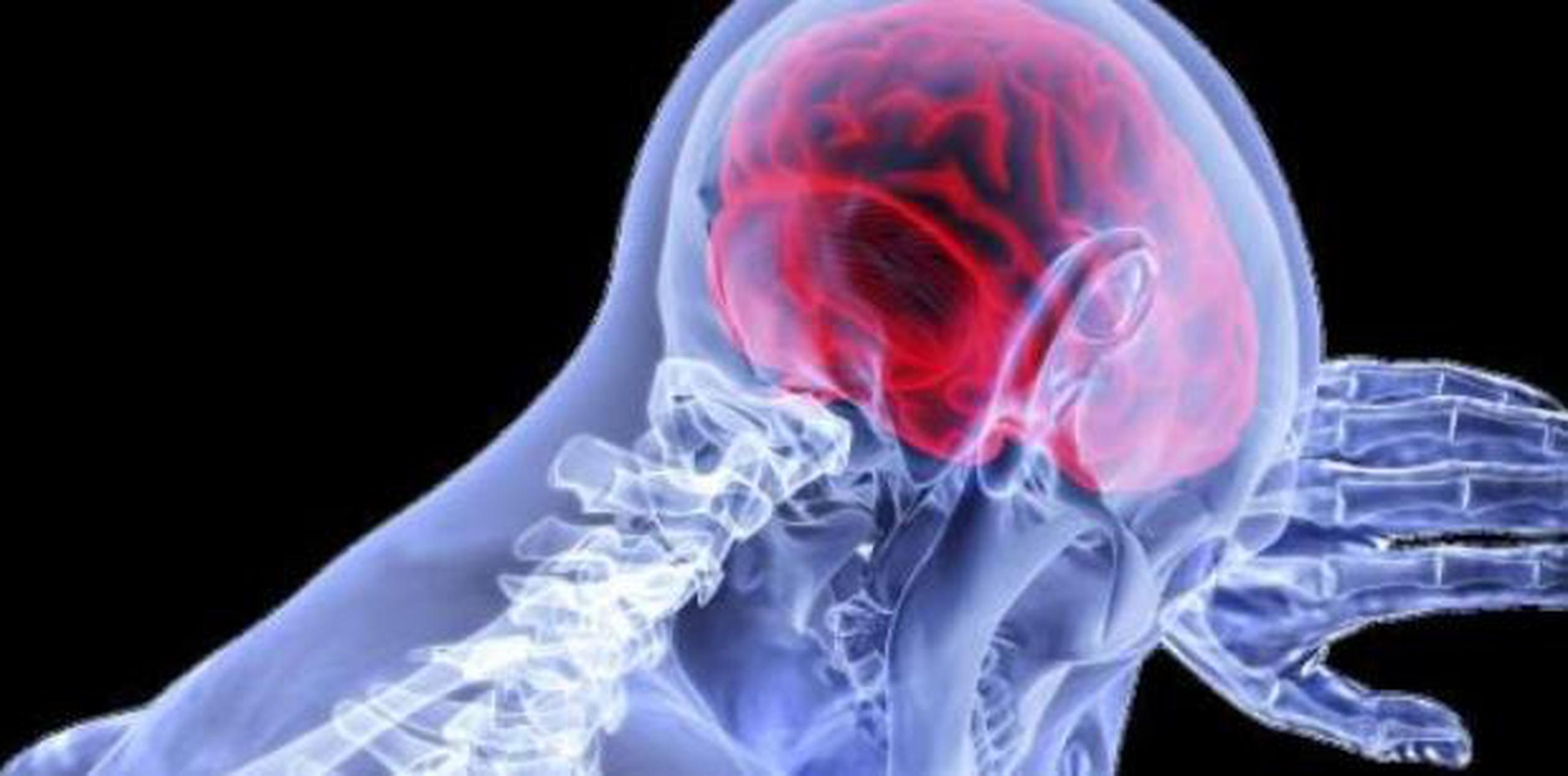 Científicos de tres países avanzan en un tratamiento de esclerosis ...