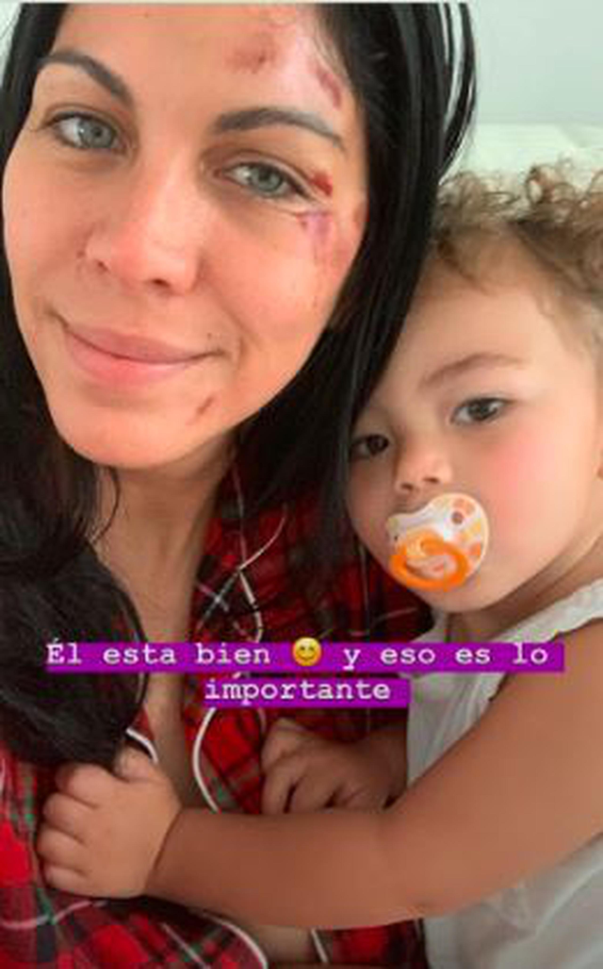 Saritza Alvarado sufre tremenda caída - Primera Hora