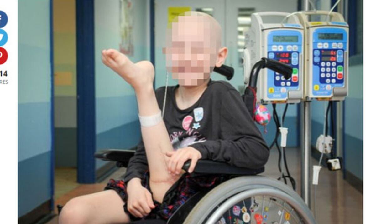 Cirujanos le amputan pierna a una niña y se la vuelven a poner al revés ...