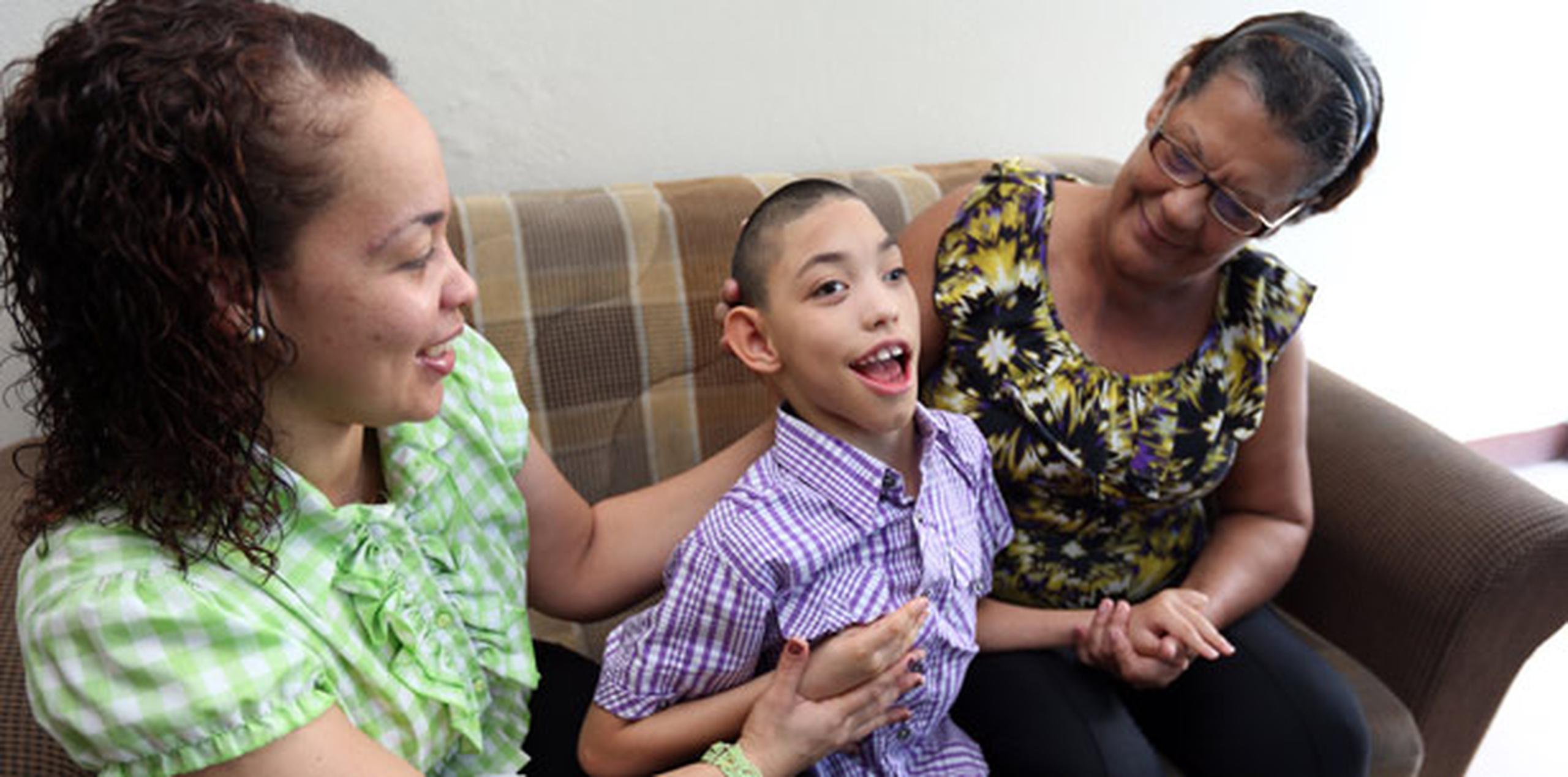 La dura realidad de un niño con microcefalia, el mal vinculado al zika ...