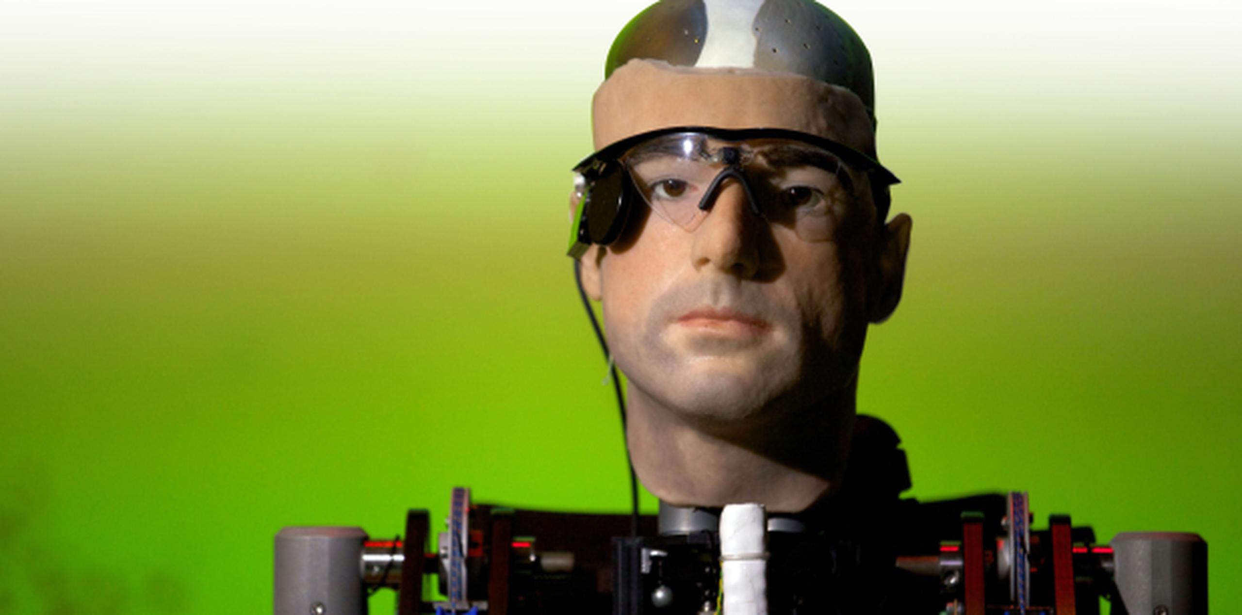 Hombre biónico Franck da sus primeros pasos-VÍDEO - Primera Hora