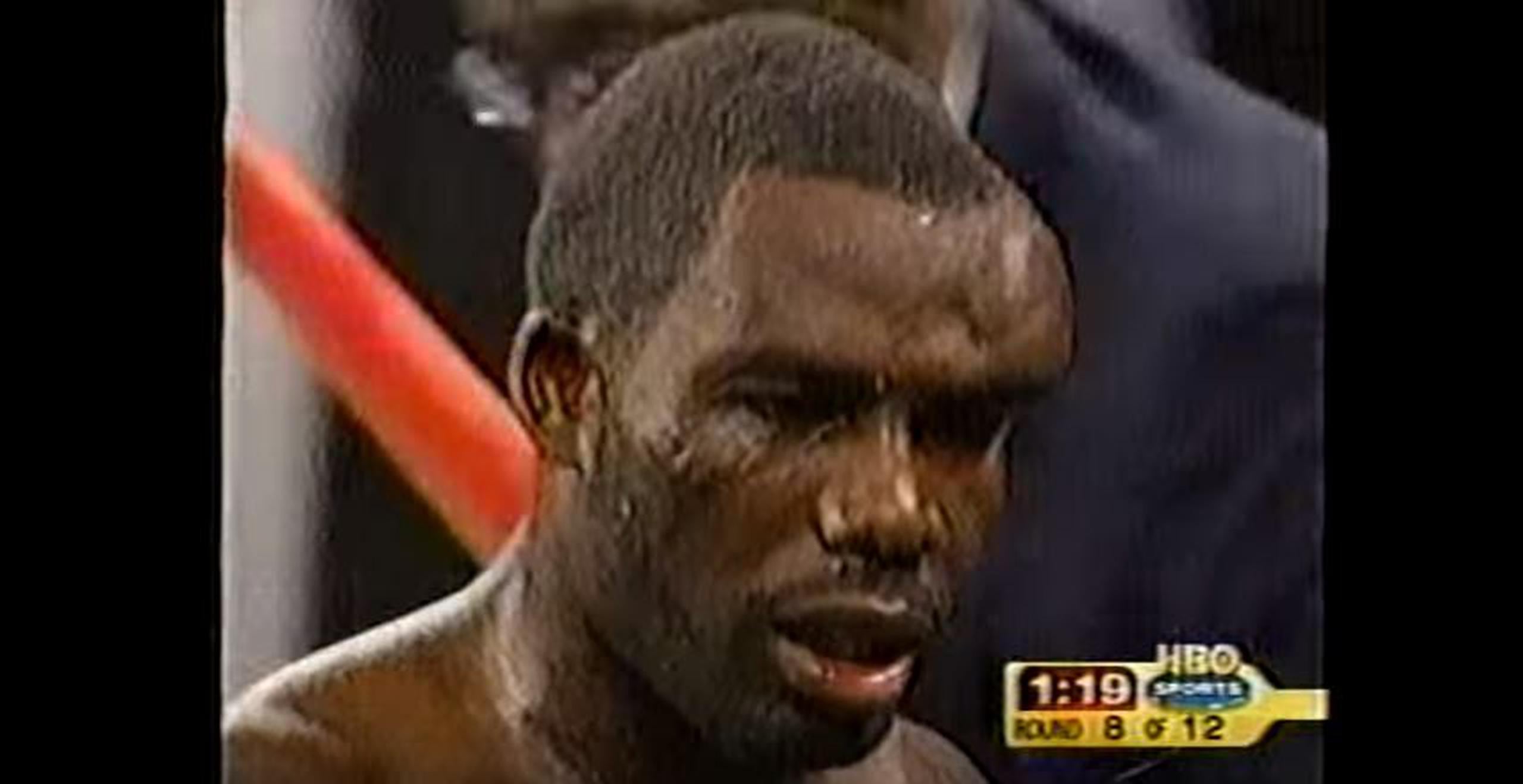 Chinchon En La Frente